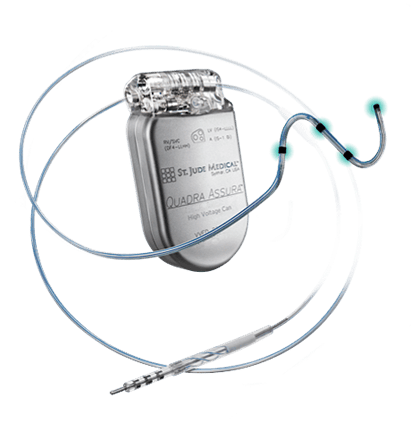 ICD te vaak niet doelmatig geplaatst - MedicalFacts.nl